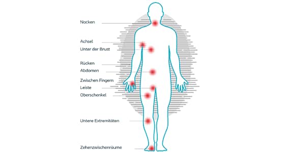 InterDry | Coloplast Wundversorgung